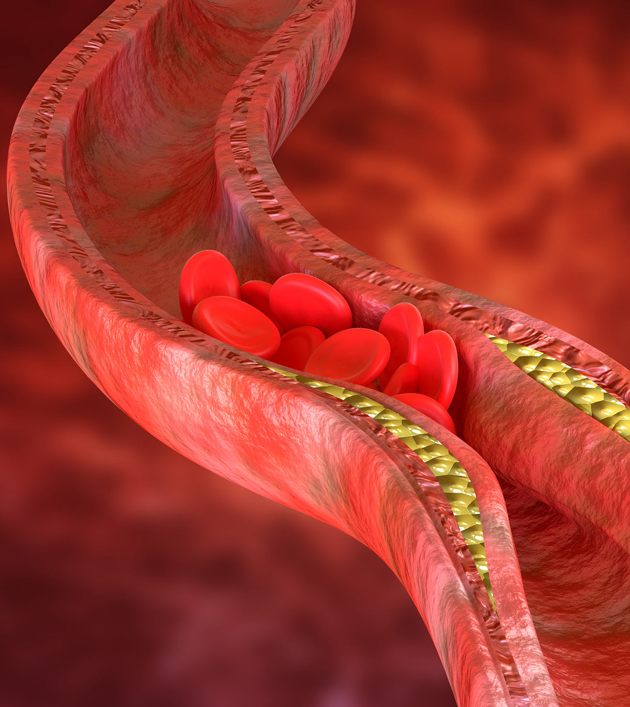 Anticoagulation - Edmonton Echolab