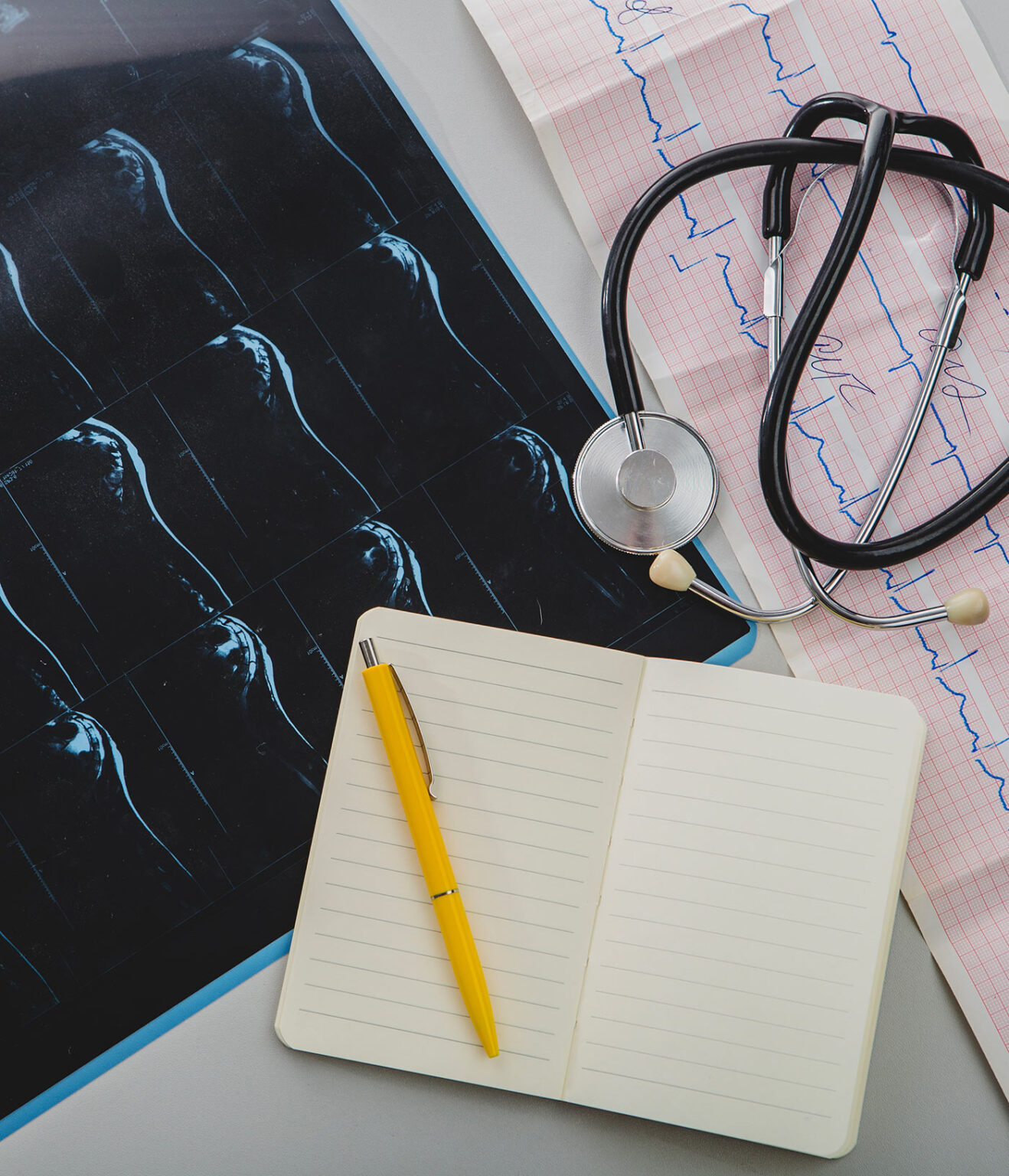 Contrast Echocardiogram - Edmonton Echolab